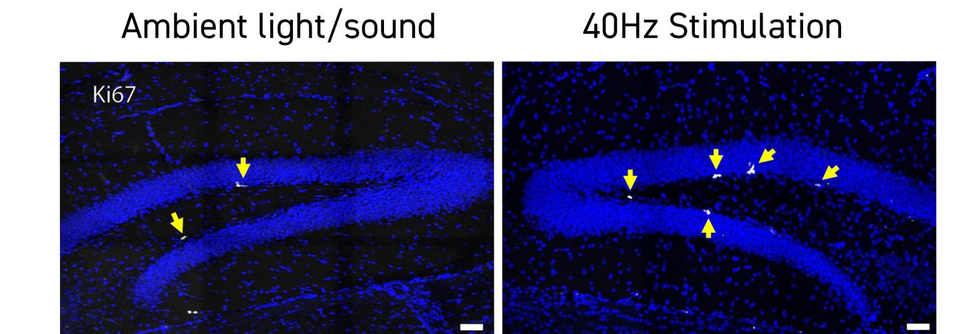 In Down syndrome mice, 40Hz light and sound improve cognition, neurogenesis, connectivity ...